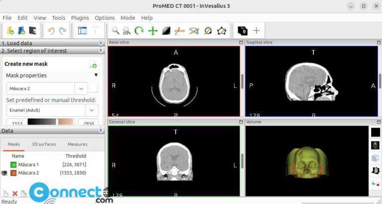 InVesalius 3D Medical Imaging Software | CONNECTwww.com